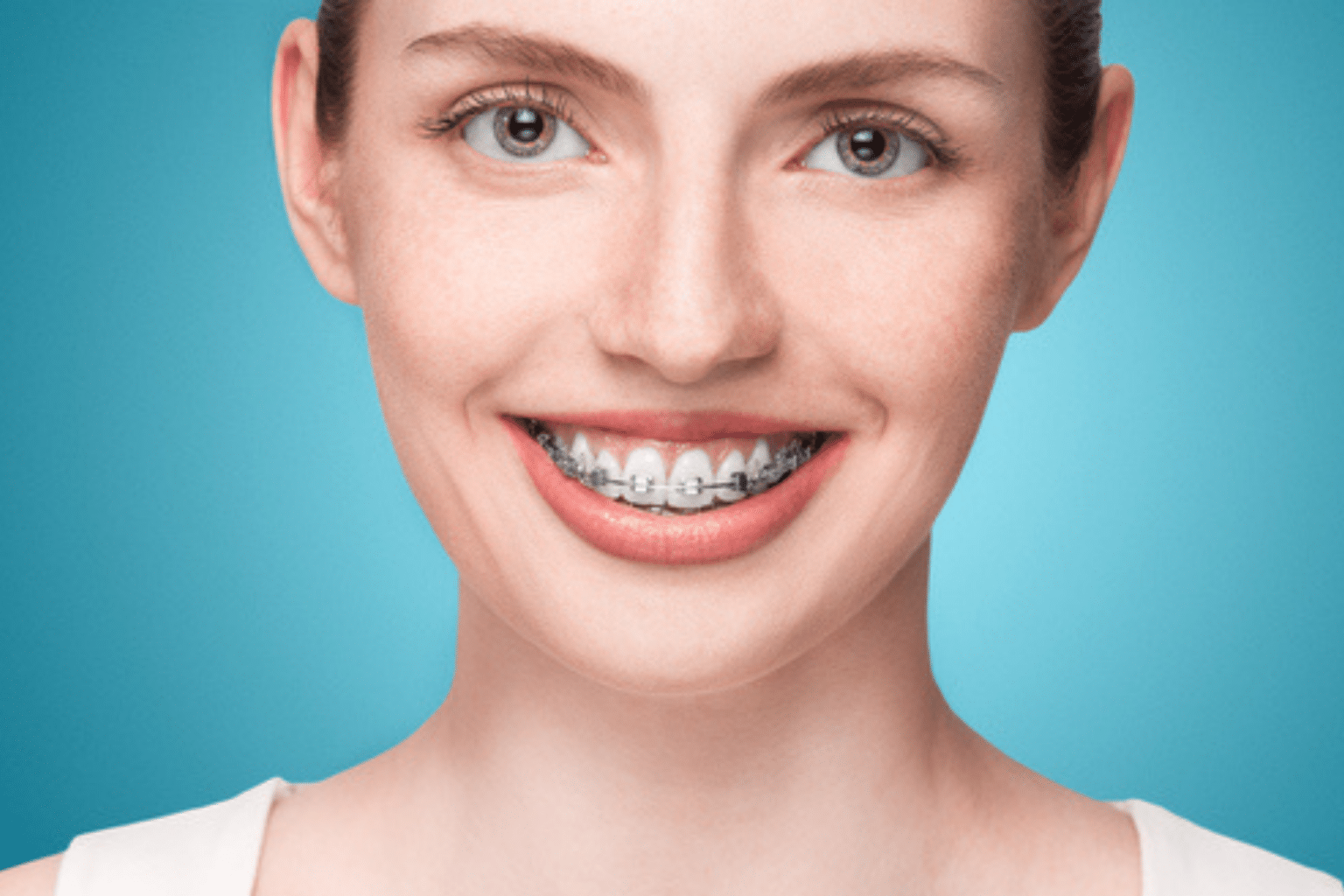 Braces Guide: Understanding Treatment and Accessing Affordable Braces ...